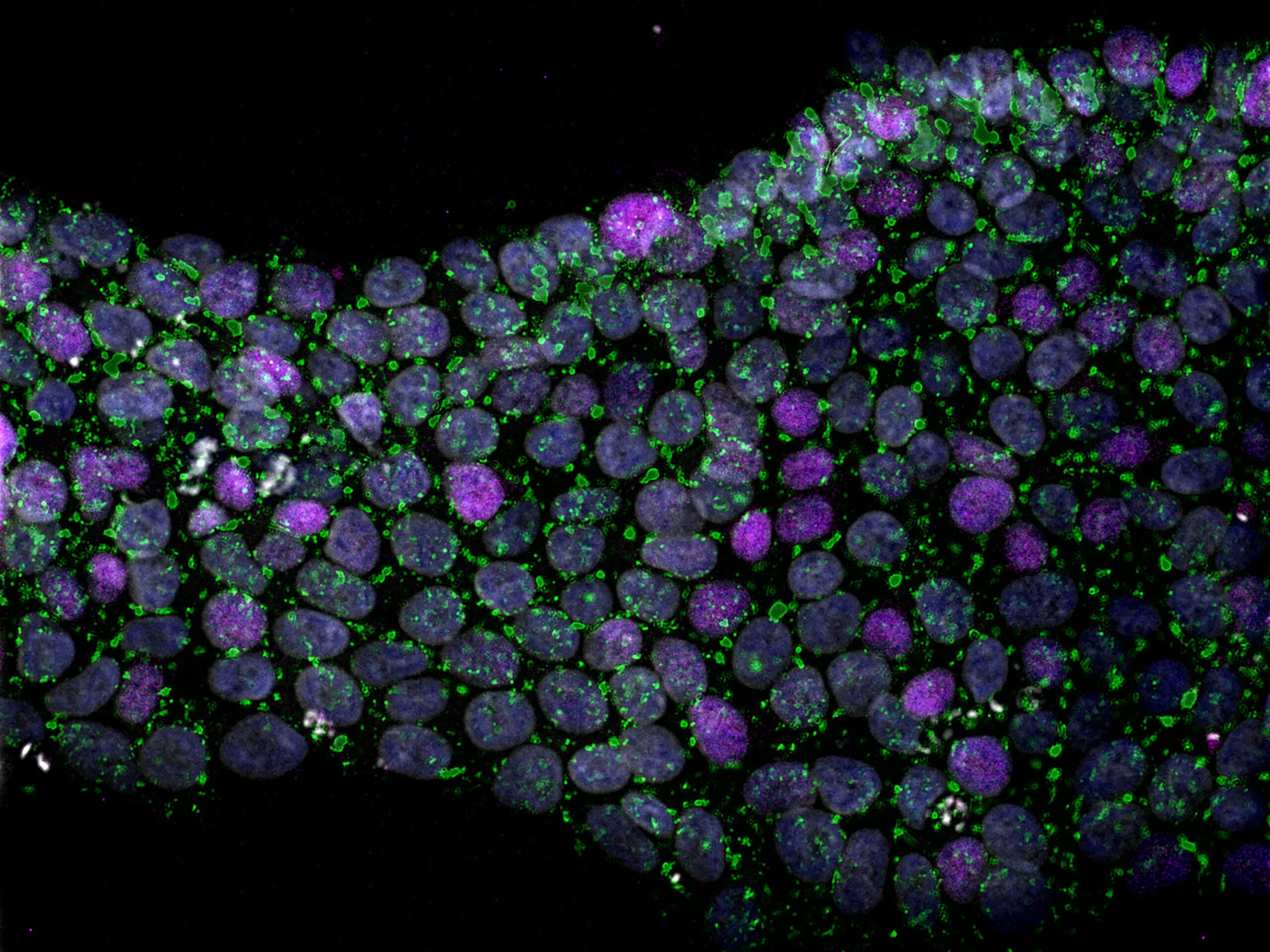 Cell Therapy - New York Blood Center Enterprises